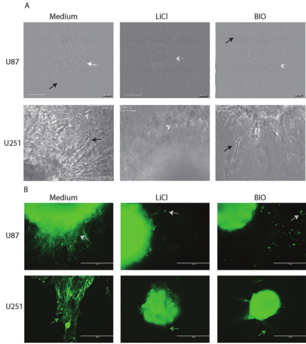 Oncoscience | High-content analysis of tumour cell invasion in three ...