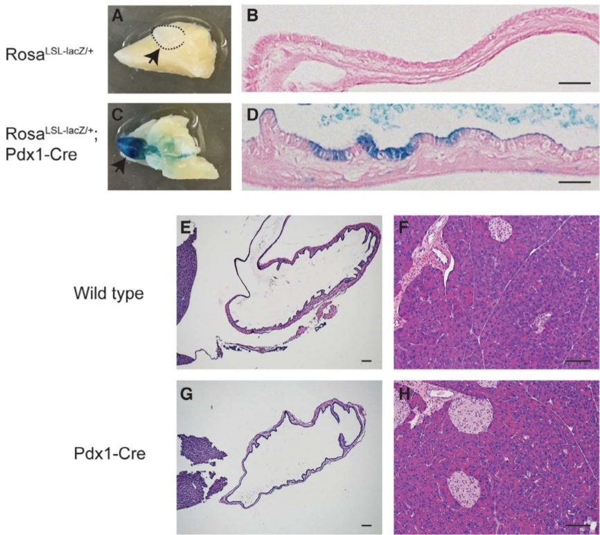 Oncoscience | Kras G12D upregulates Notch signaling to induce ...